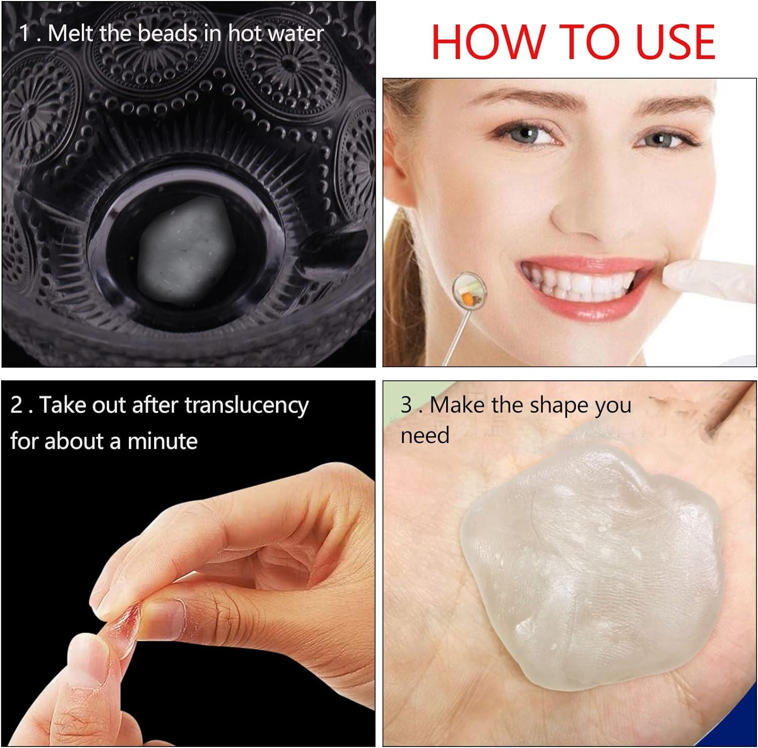 60g Temporary Dental Repair Set - Adhesive for Missing & Broken Teeth ...