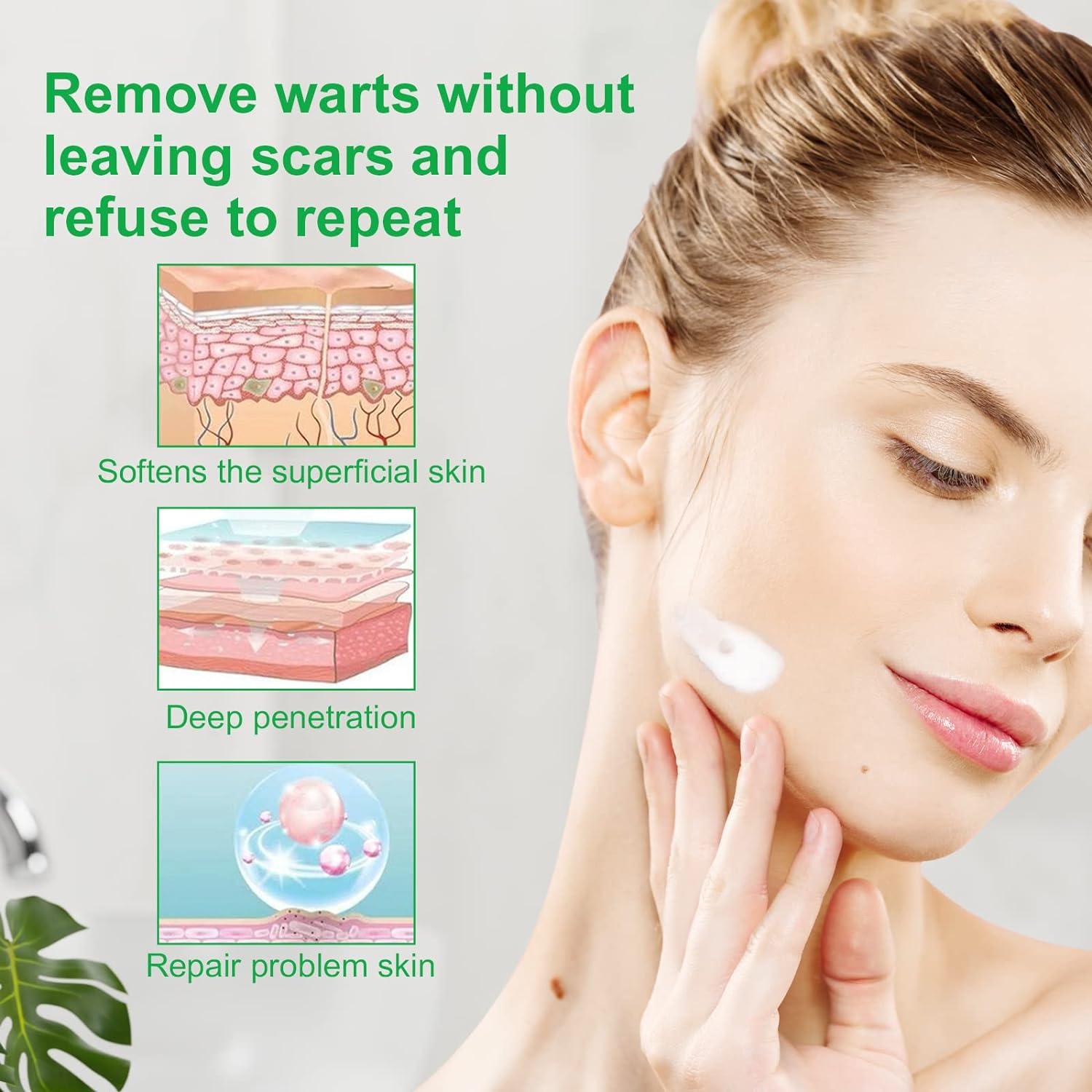 GNAPY Skin Tag & Wart Remover Cream - Natural Treatment Formula for ...