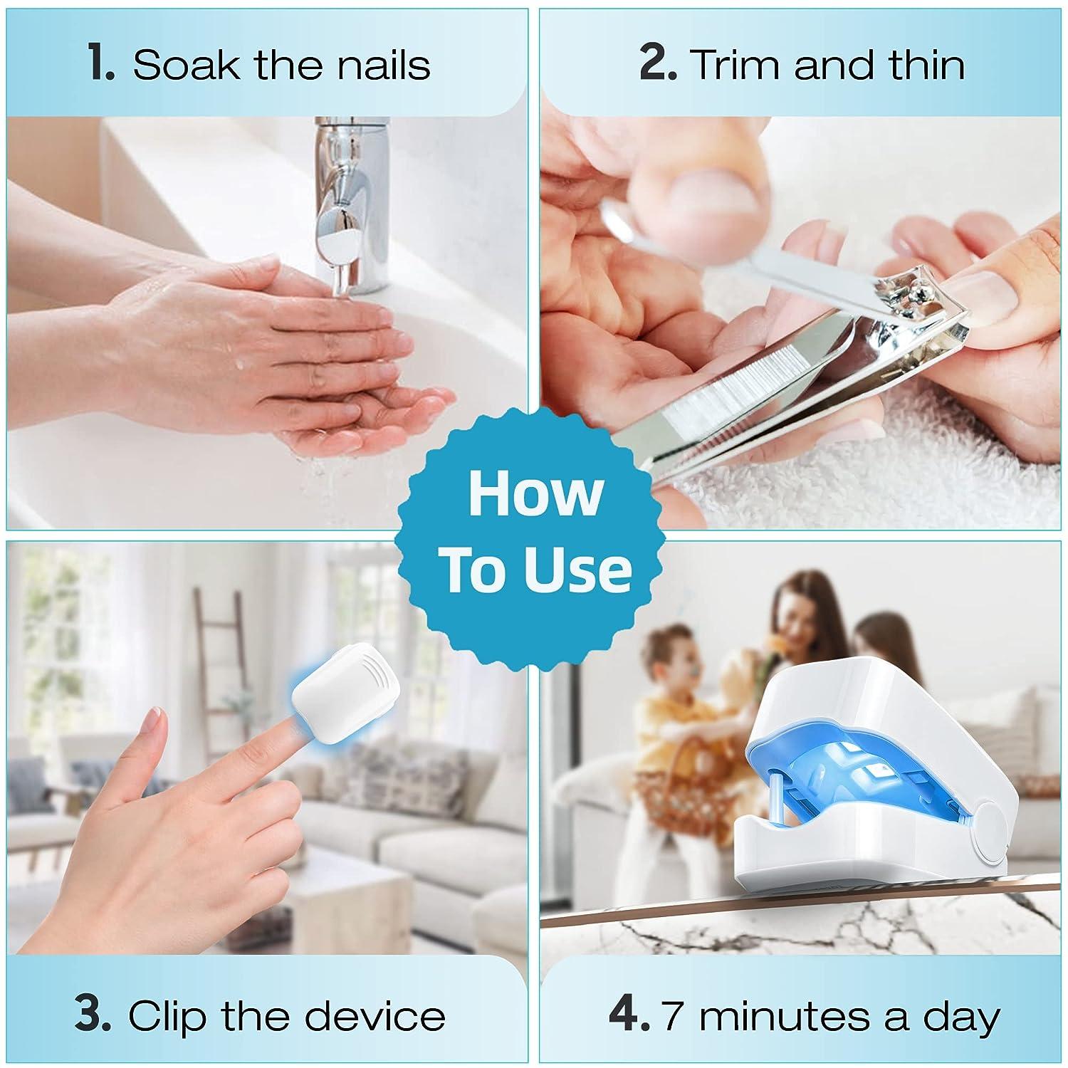 Home-Use Nail Fungus Cleaning Laser Device for Toenail & Fingernails ...