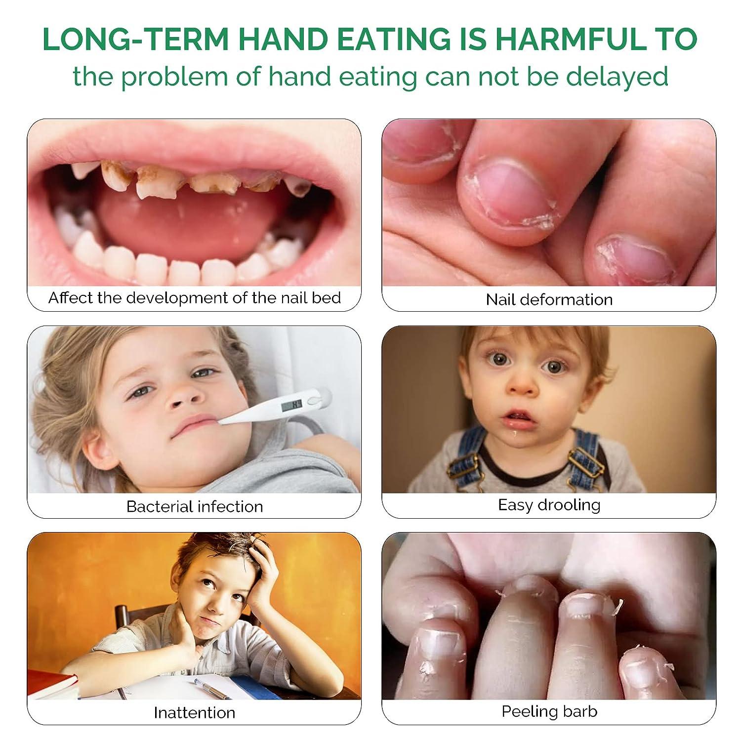 Kids Nail Biting Treatment - Anti-Biting Thumb Sucking Stop - Natural ...