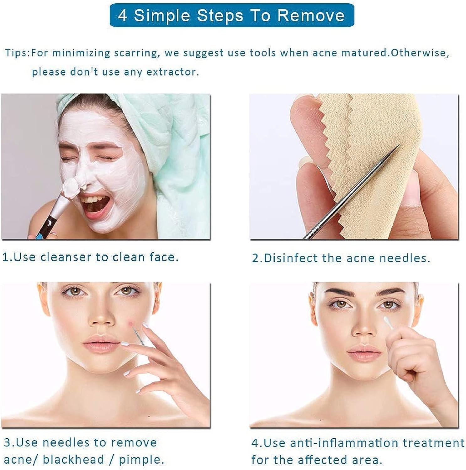 Blackhead Remover Pimple Extractor Tool Acne Kit - Blemish Treatment ...