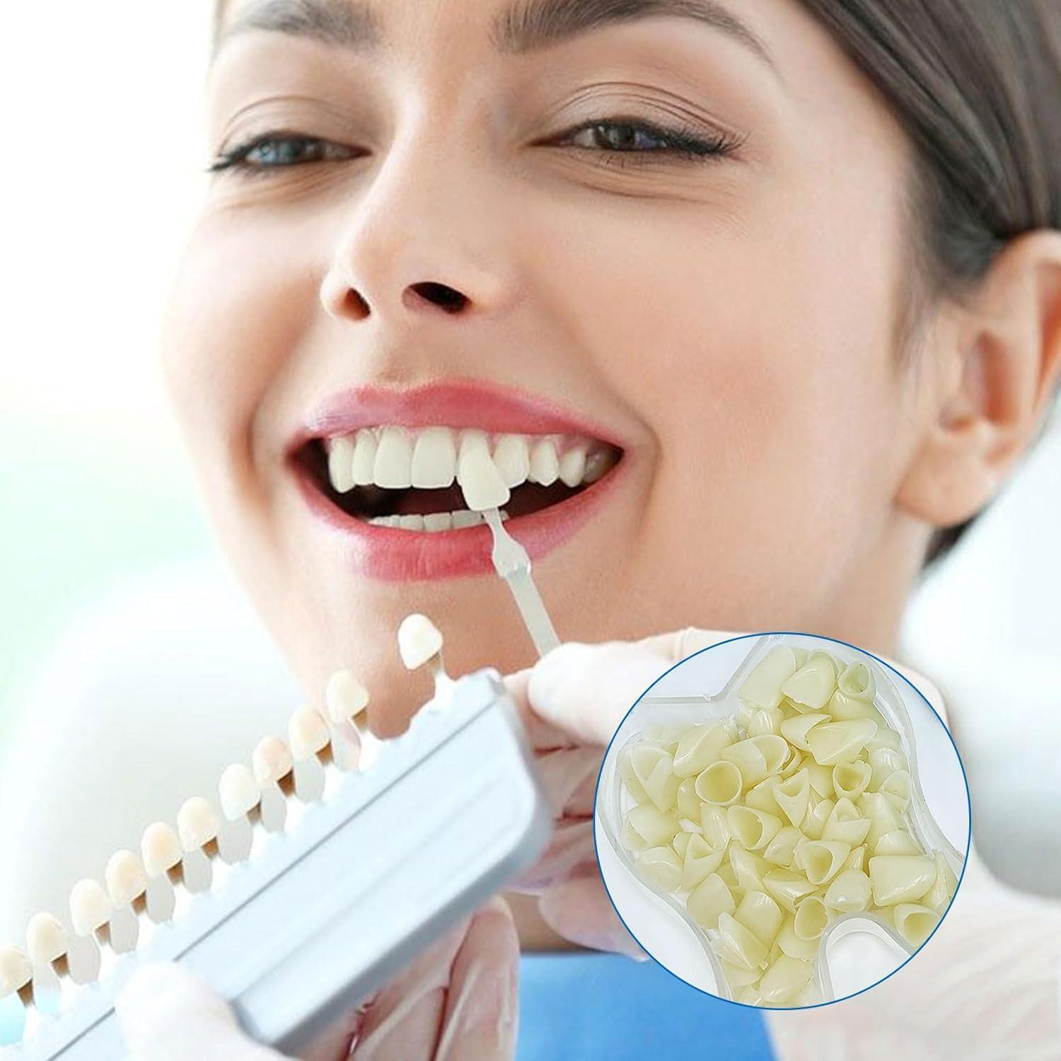 Skhaovs 100-Piece Temporary Tooth Crown Denture Set - Provisional ...