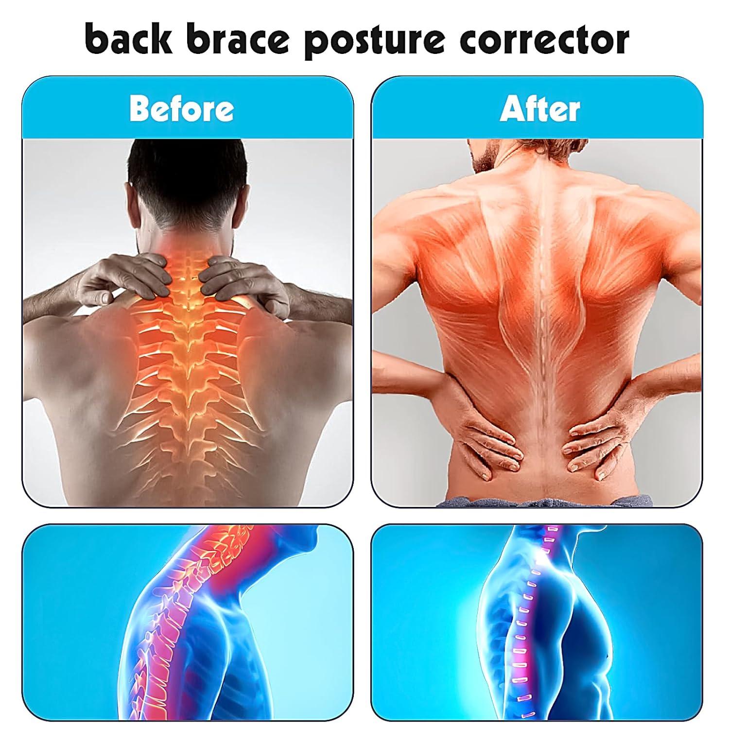 Posture Corrector for Men & Women - Adjustable Back Brace for Neck ...