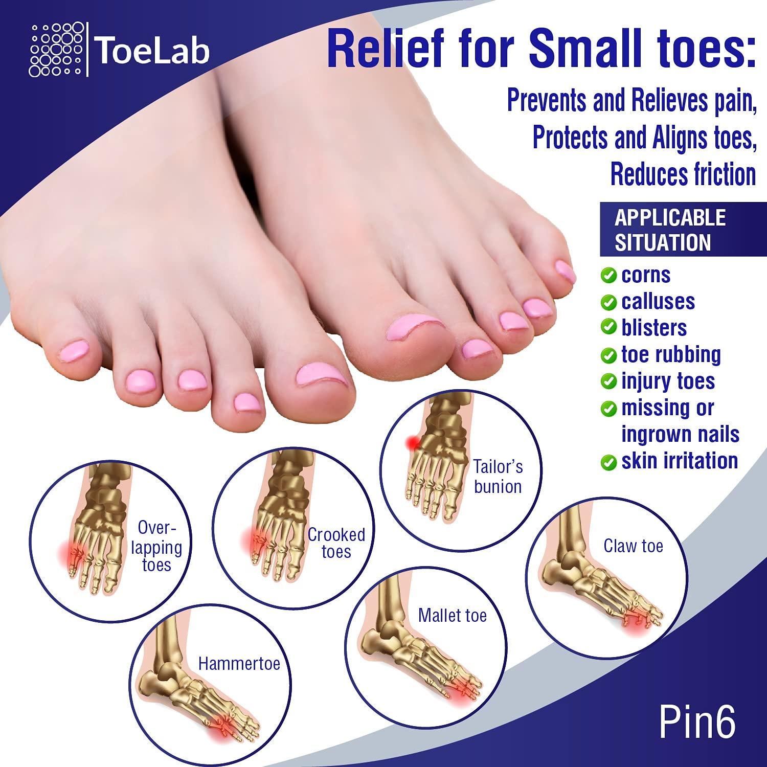 ToeLab Pinky Toe Separators and Splint Set - 6 Pieces for Baby Toe ...