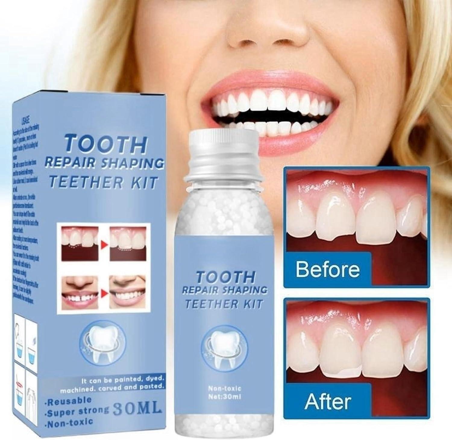 Temporary Tooth Repair Kit | Modable False Teeth & Filler Granules ...