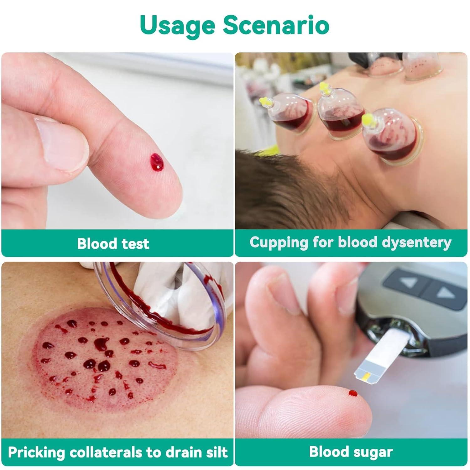 Blood Lance Pen - Stainless Steel Acupuncture Massager for Pain Relief ...