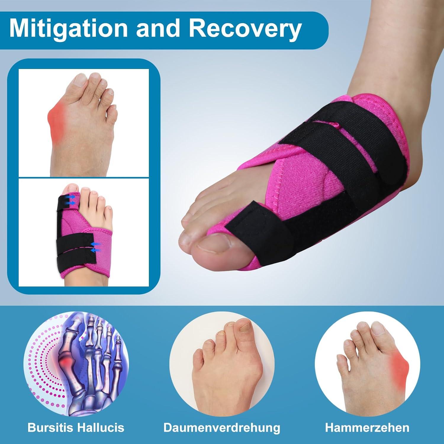 Hallux Valgus Correction Rail - Relief for Large Toe Pain Align Toes ...