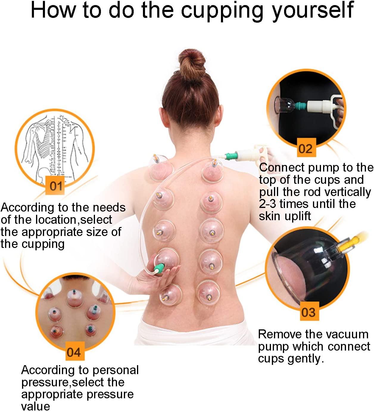 AIKOTOO 32 Cups Cupping Set with Pump | Hijama Cupping Therapy Kit for Acupoint Massage ...