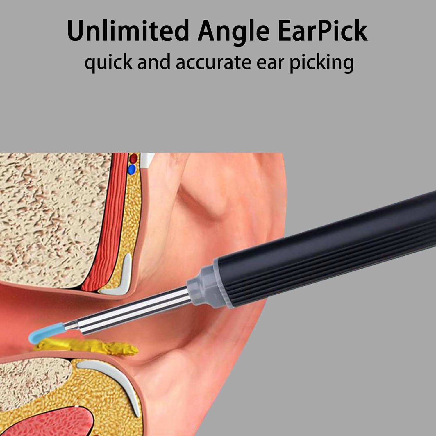 Wireless Ear Wax Removal Tool with Camera - Professional Ear Inspection ...
