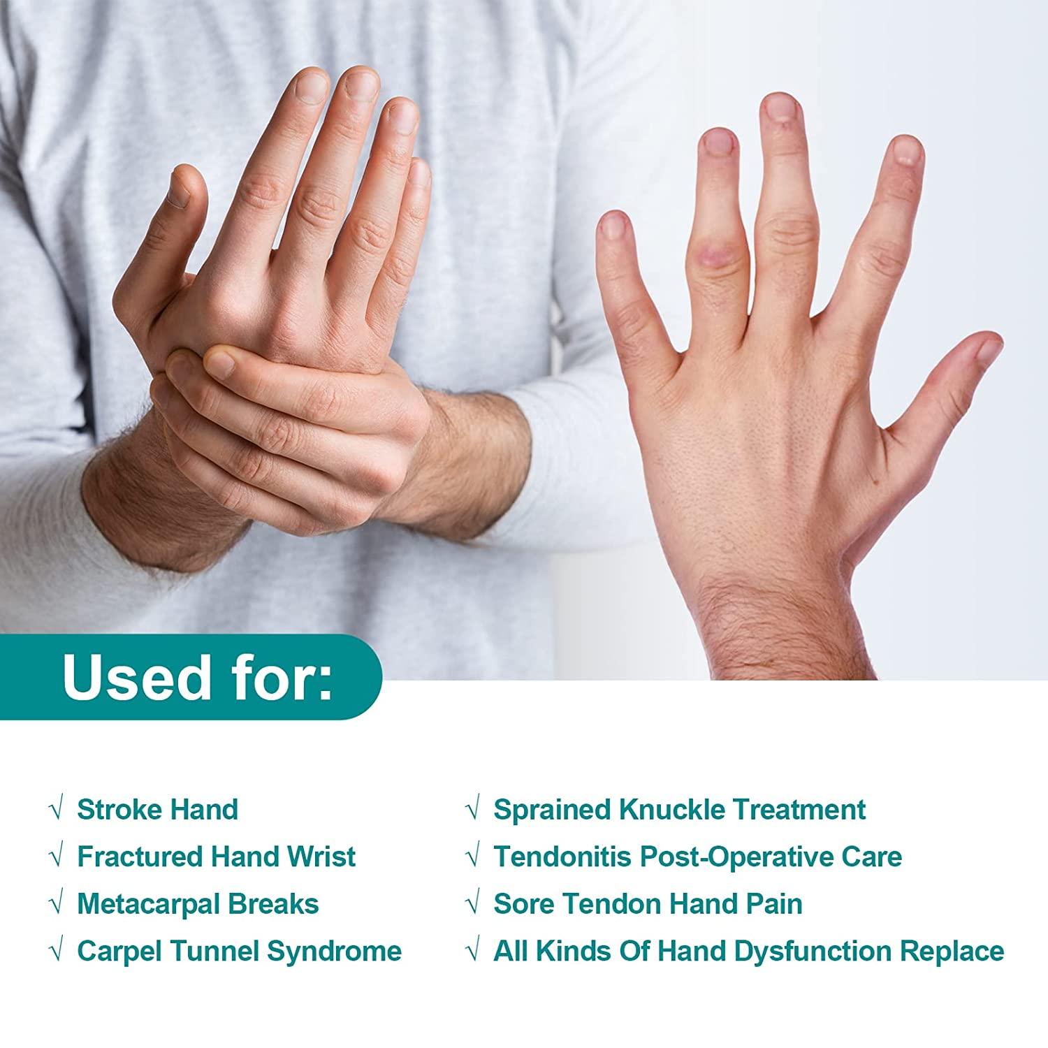 Sylong Stroke Resting Hand Splint - Carpal Tunnel Wrist Brace for ...