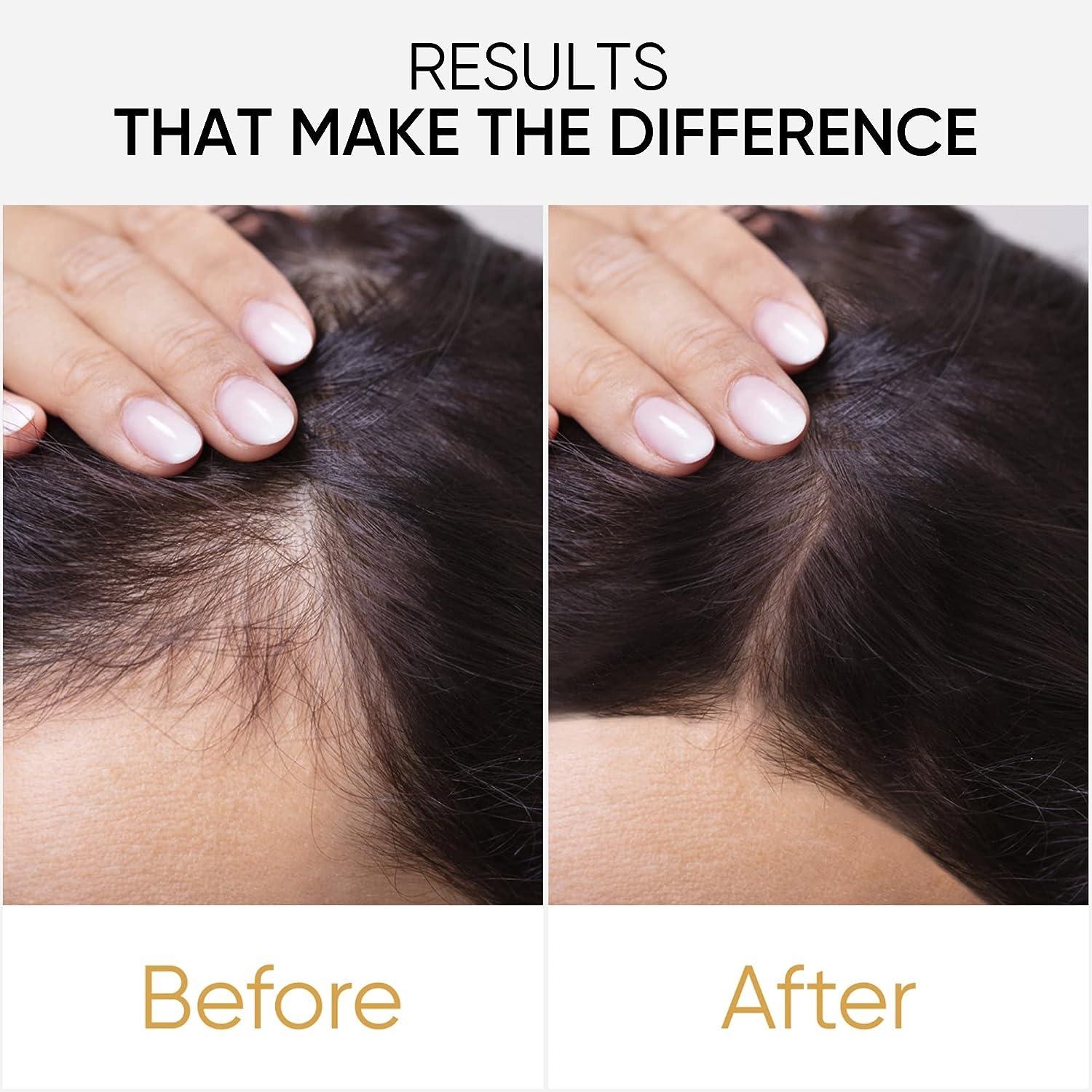 Maska Intensive Hair Growth Scalp Serum - 4.5 FL OZ for Thicker ...