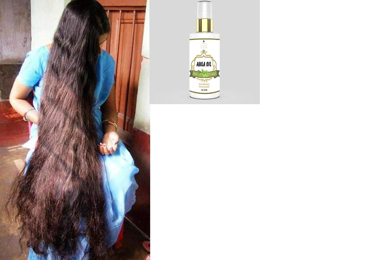 Organic Amla Oil for Hair Growth - 100% Pure Indian Gooseberry Scalp ...