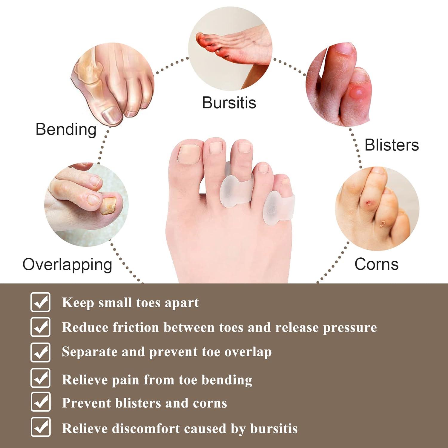 10 Pcs Gel Toe Separators for Overlapping Toes - Pinky Toe Spacers for ...