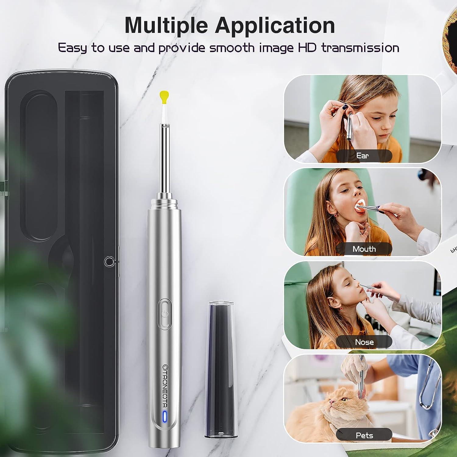 OTAONE Ear Wax Removal Tool with 1296P FHD Camera & Built-in WiFi - iOS ...