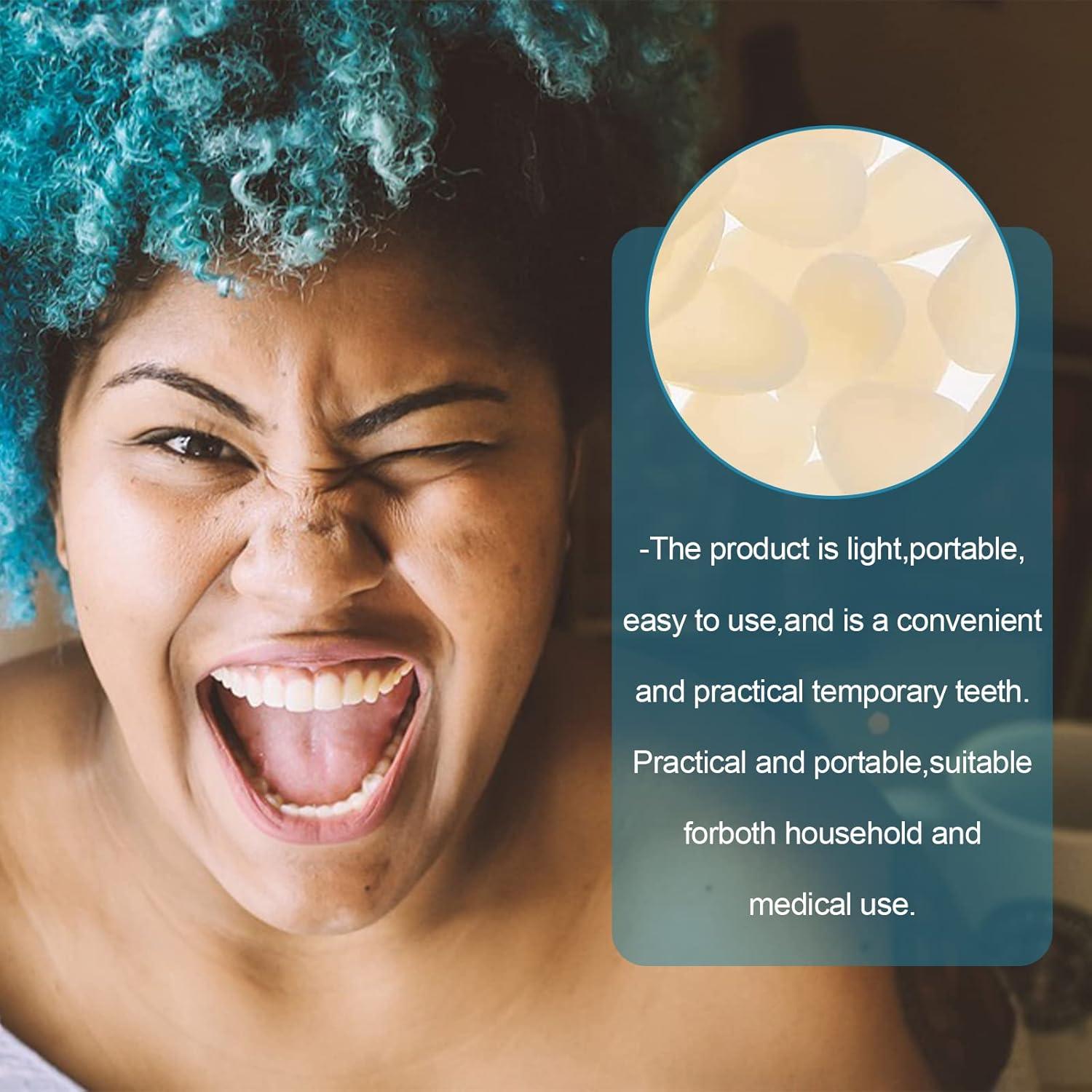 100pcs Temporary Crowns of Tooth Crowns 2 Types of Strong Temporary ...