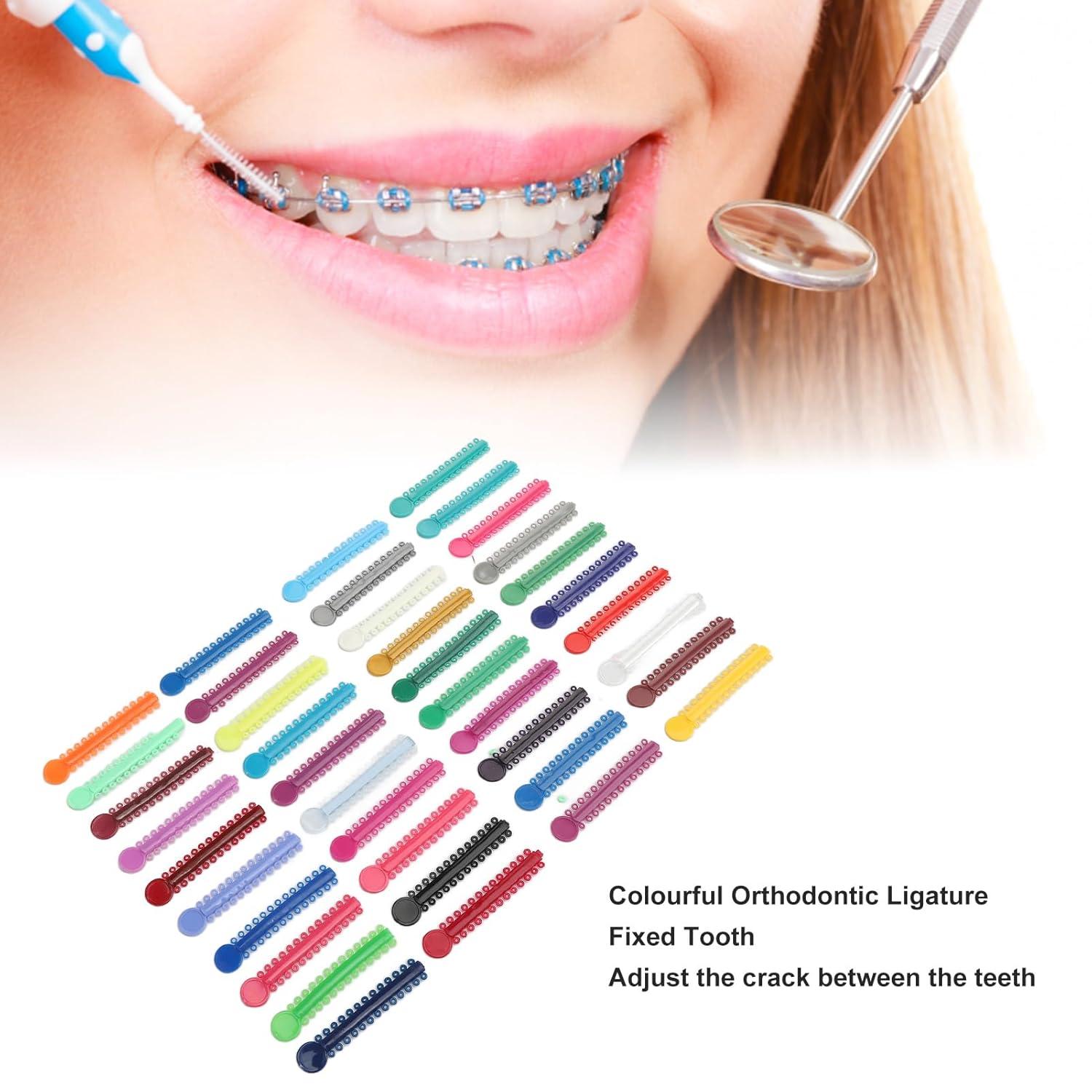 Orthodontic Ligature Rubber Bands (40 pcs) | Colorful Dental Ties for ...