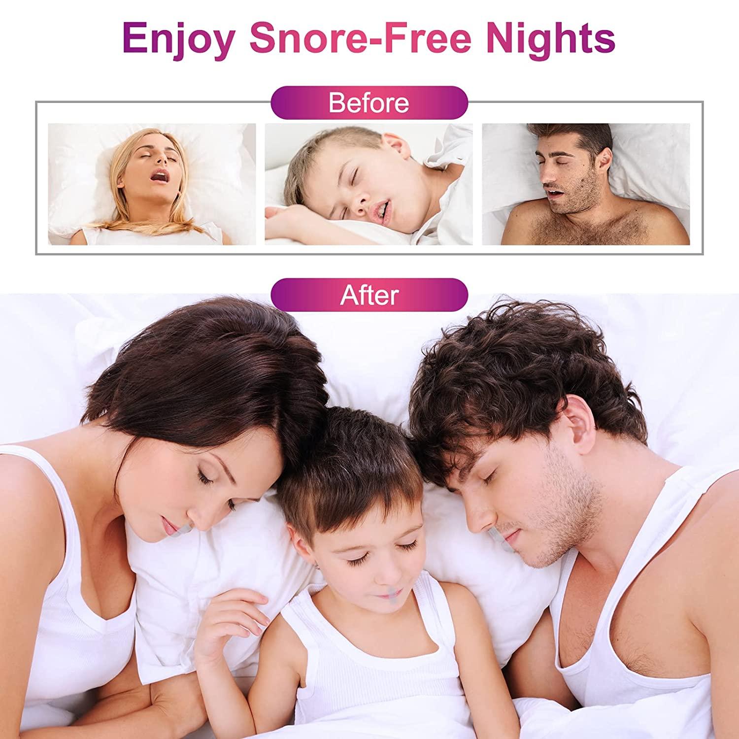 144 Mouth Tape Roll for Better Nasal Breathing and Instant Snoring ...