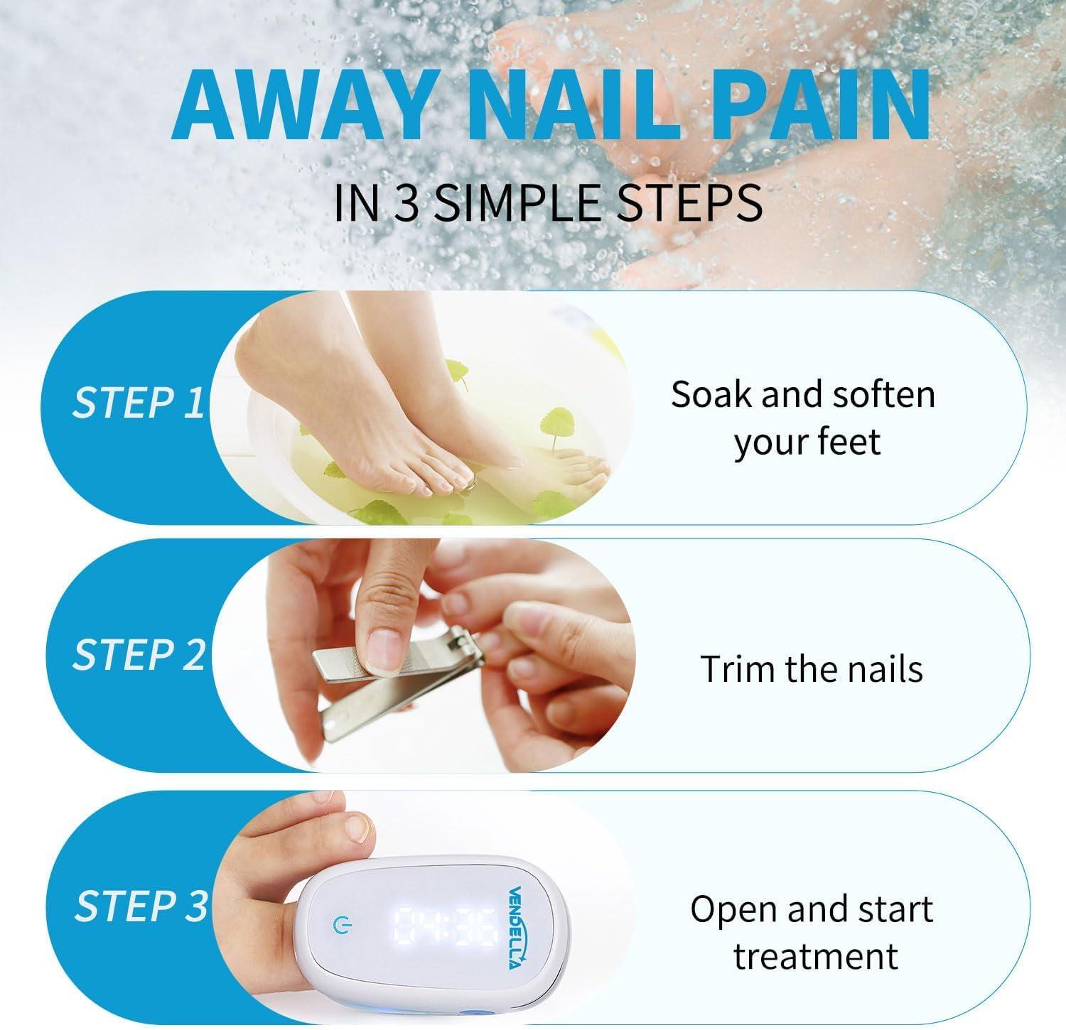 Nails Fungus Treatment Device VENDELLA Rechargeable Nail Fungus Laser ...