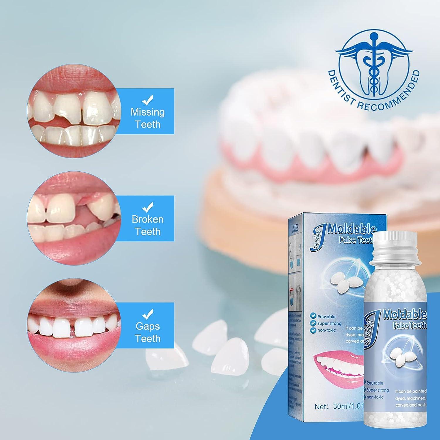 Temporary Tooth Repair Kit for Missing and Broken Teeth - Fake Teeth ...