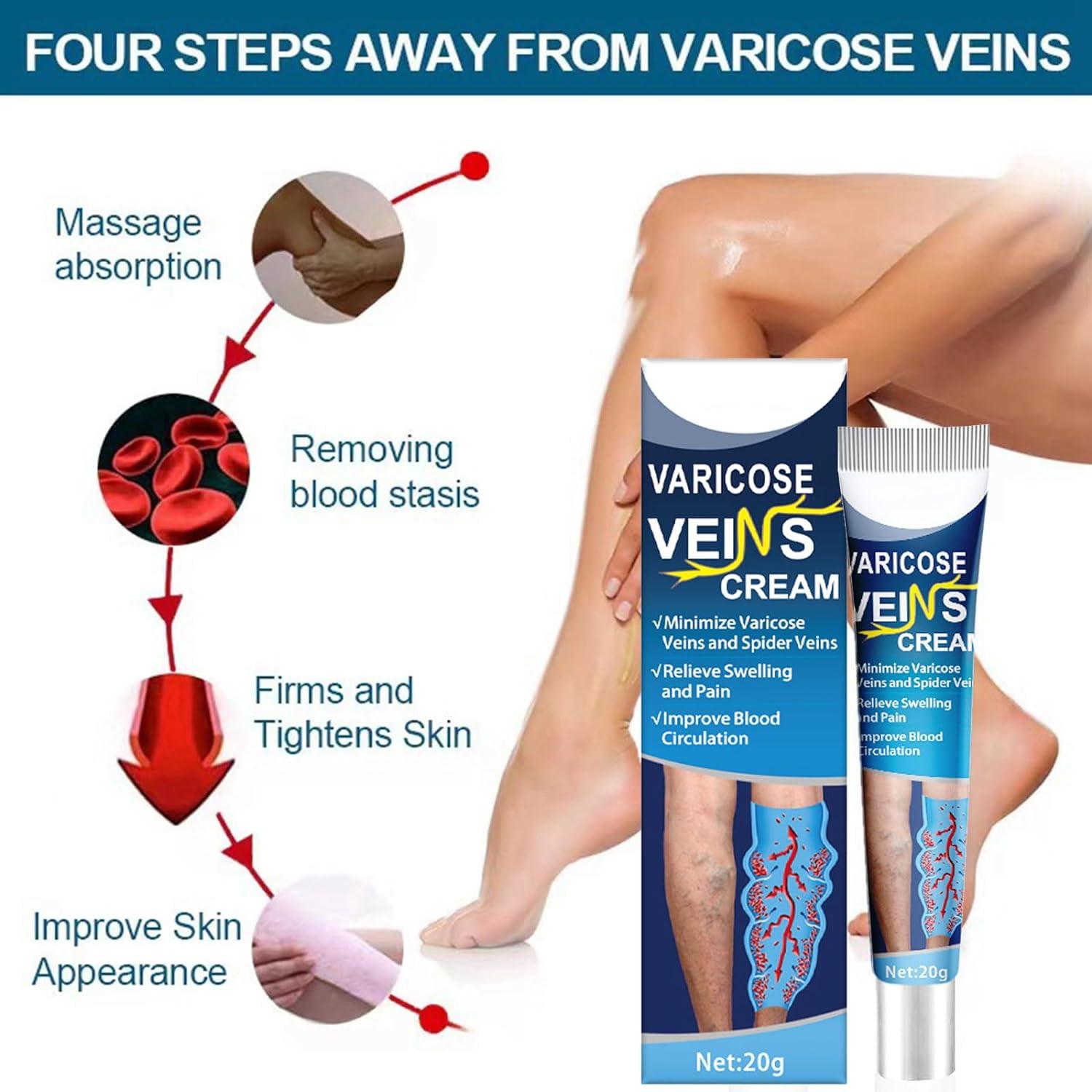 Varicose Vein Cream 20g - Pain Relief & Spider Veins Repair | Buy Now ...