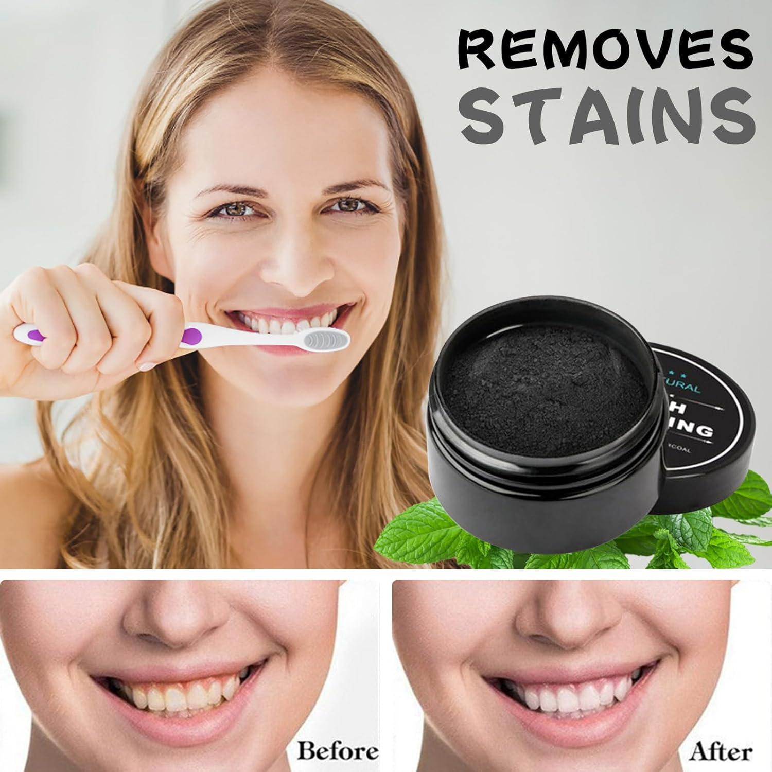 30g White Cheeky Tooth Whitening Powder - Natural Coconut Activated Charcoal for Stain Removal ...