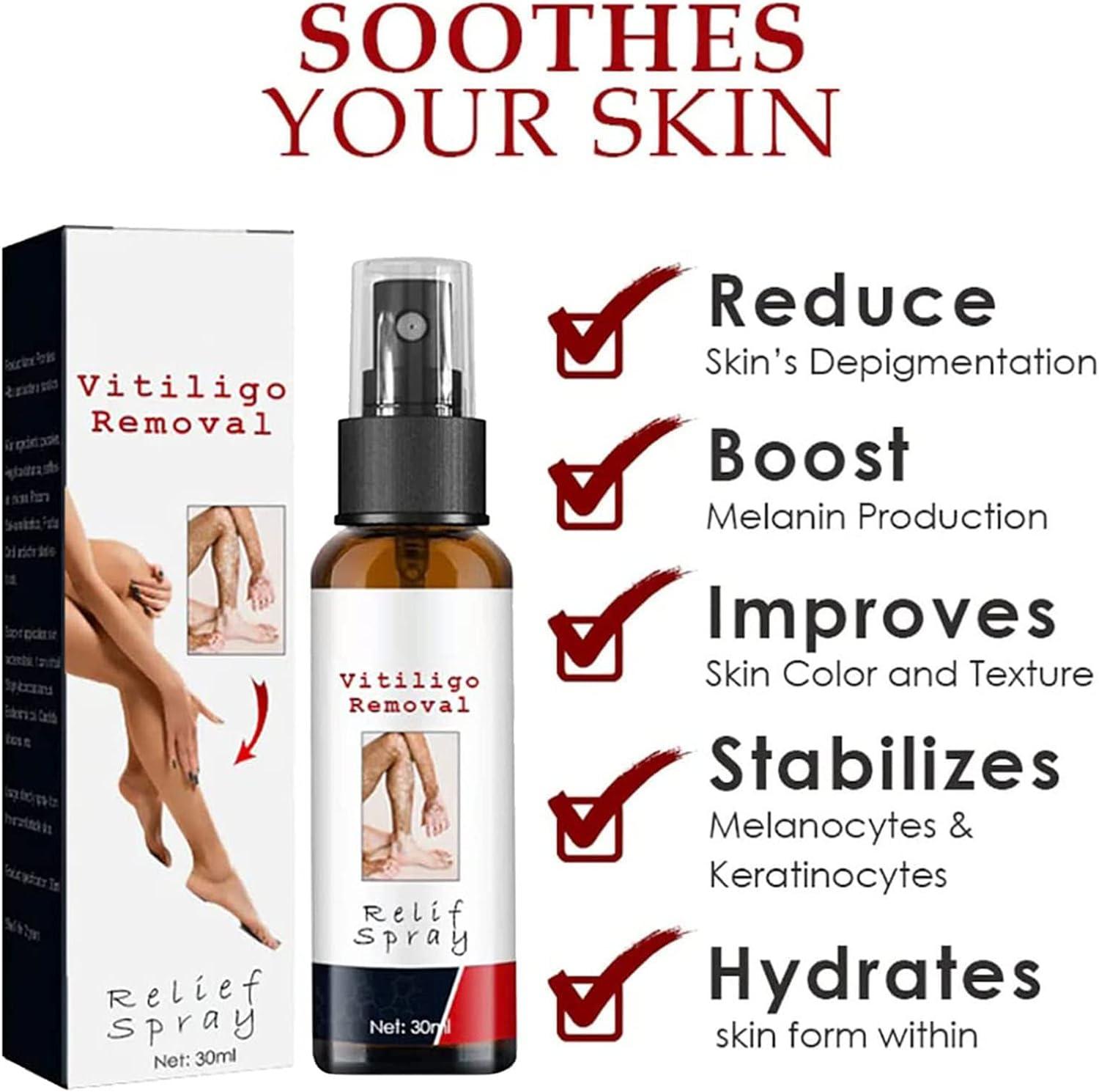 Vitiligo Removal Relief Spray | Skin Repair & Care | Reduces White ...