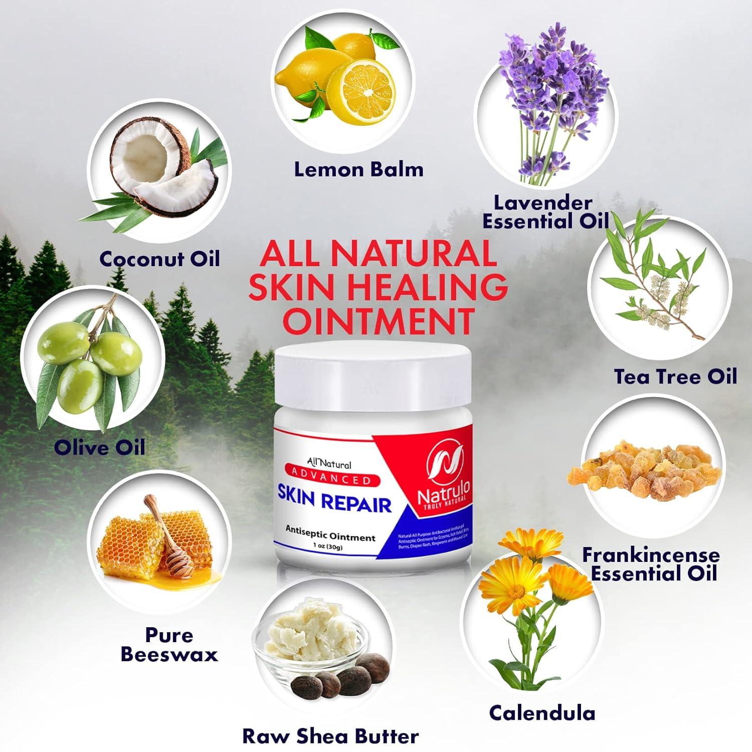Natrulo Skin Repair Cream for Eczema, Itch Relief, Burns, and more ...