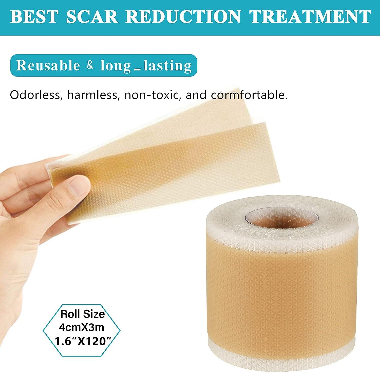 Medical Grade Silicone Scar Sheets - Reusable Scar Tape for C-Section ...