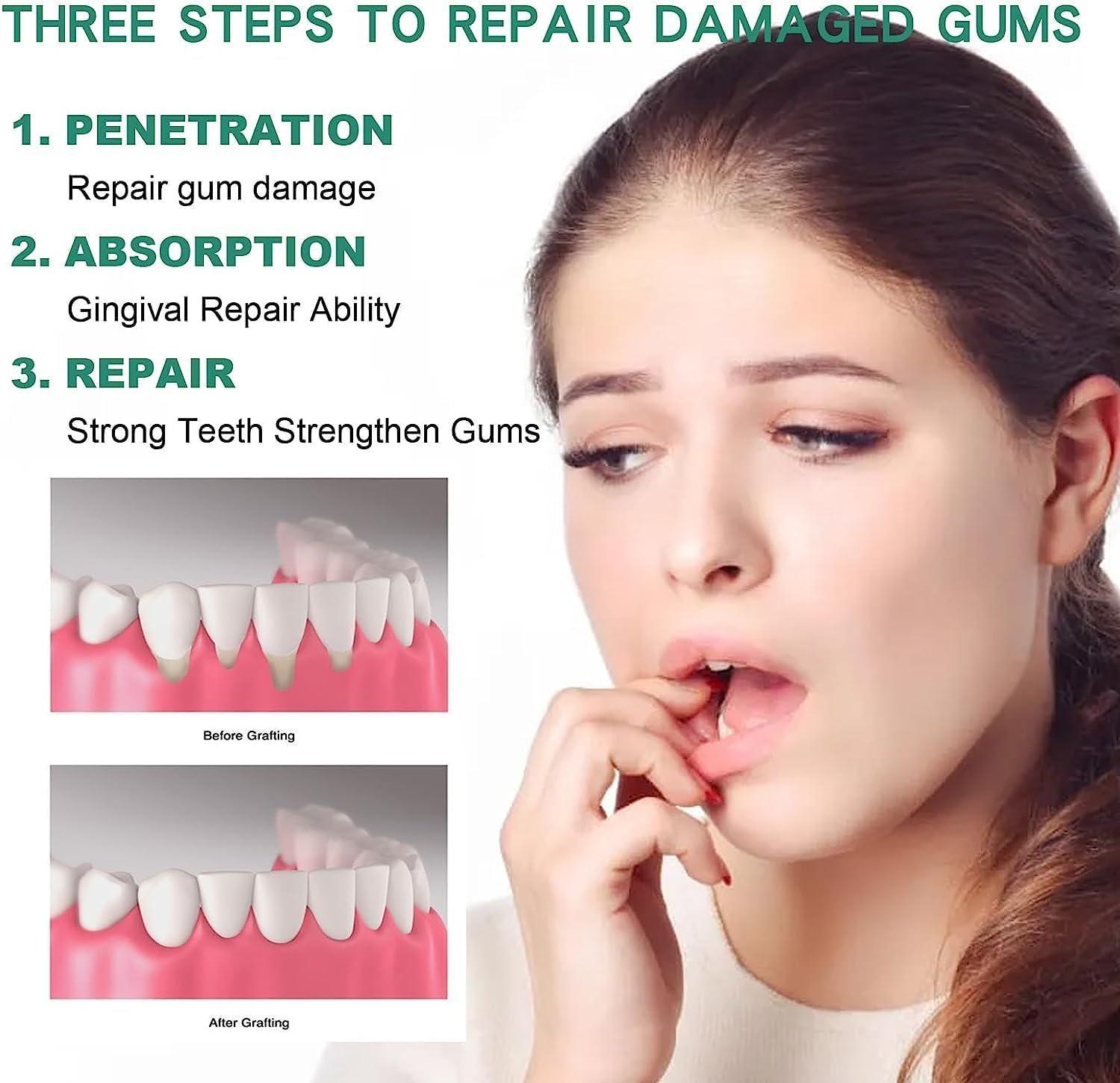 Dentizen Gum Regrowth Drops - Receding Gum Repair & Disease Treatment ...