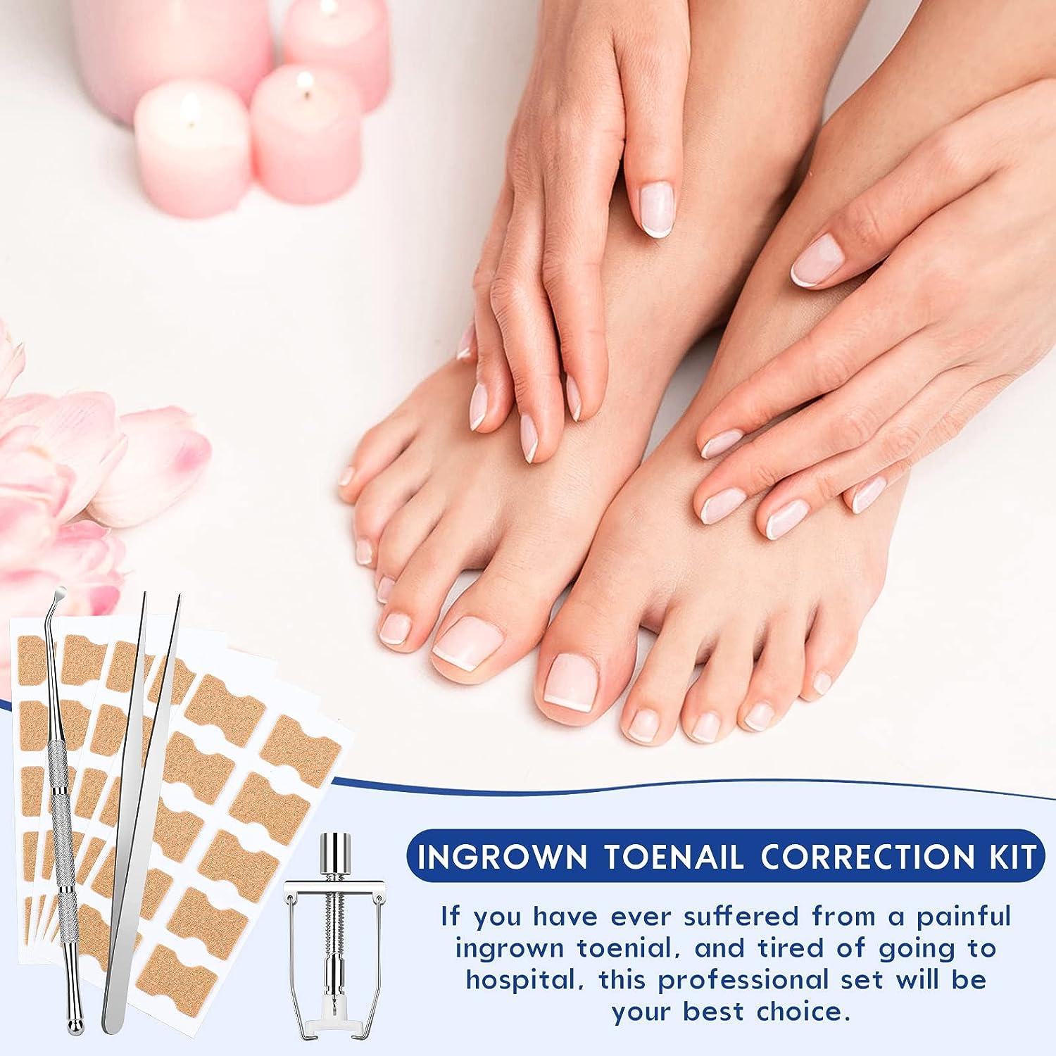 Professional Ingrown Toenail Treatment Kit - Includes Toenail Corrector ...