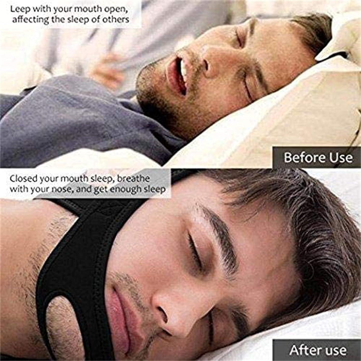 ANYURAN Stop Snoring Chin Strap Snoring Solution Anti Snoring Devices ...