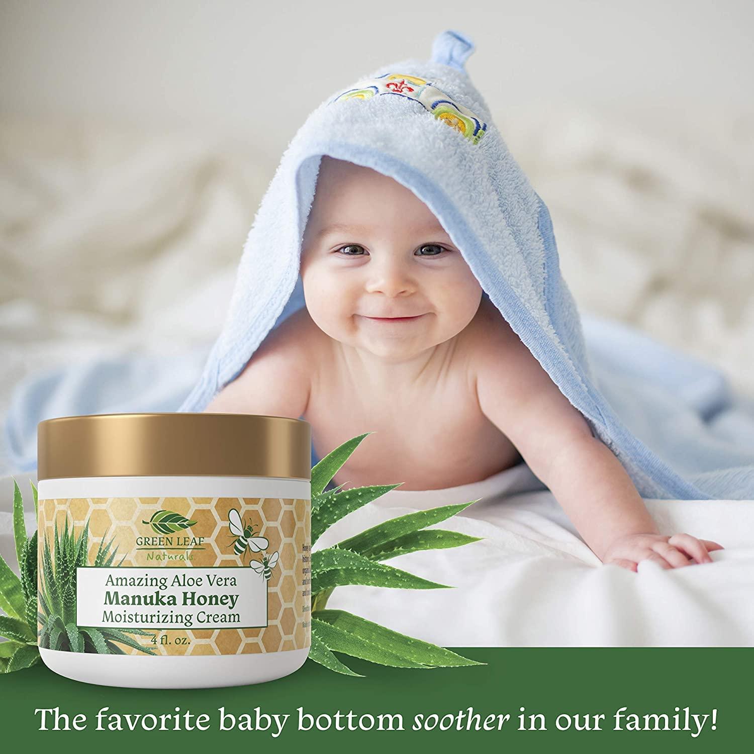 Manuka Honey Eczema Cream (8oz) - Psoriasis & Itchy Skin Relief ...