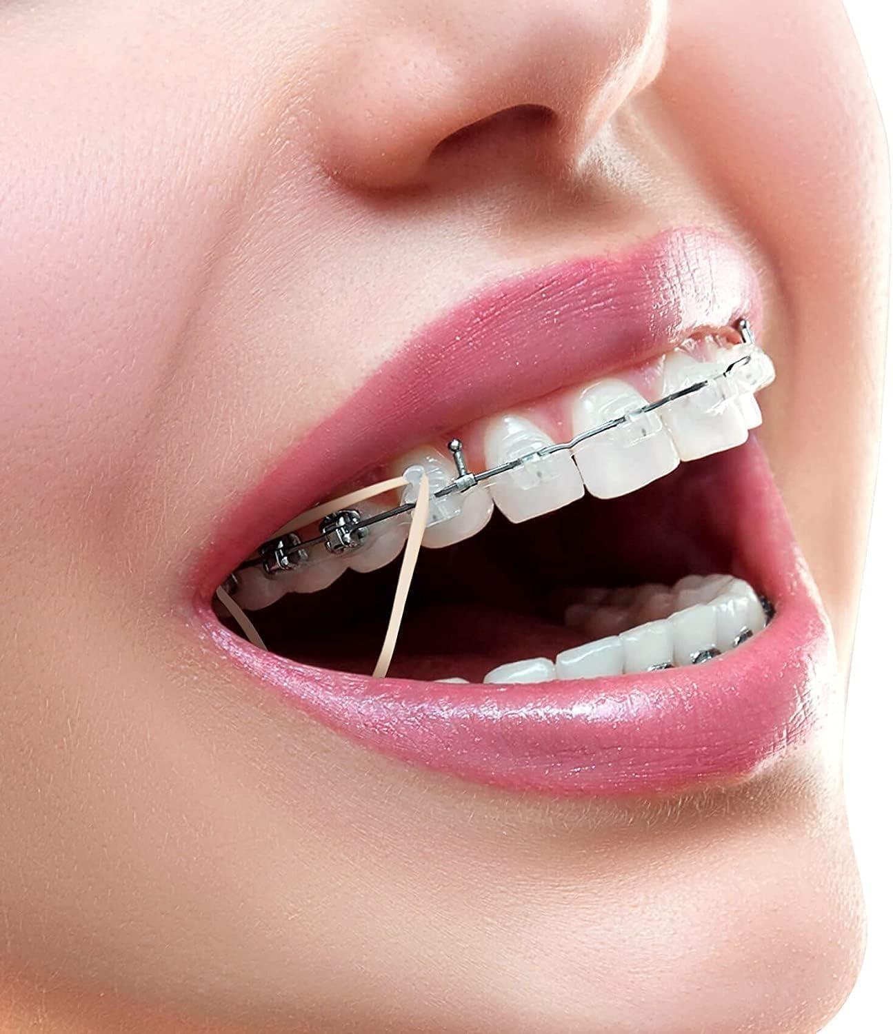 500PC Orthodontic Rubber Bands for Braces - Elastic Teeth Bands & Wax ...