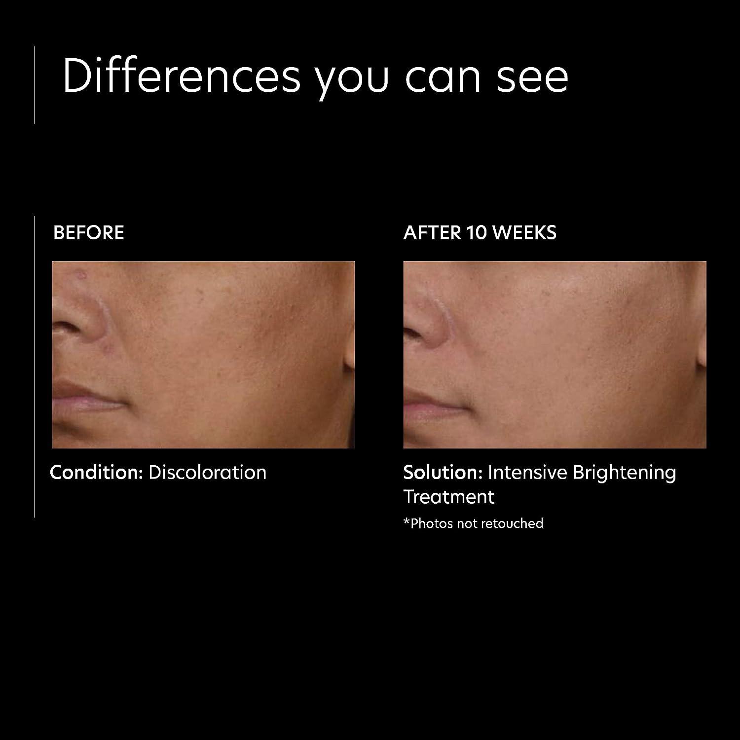 PCA SKIN Intensive Brightening Treatment - Vitamin A Retinol Serum for ...