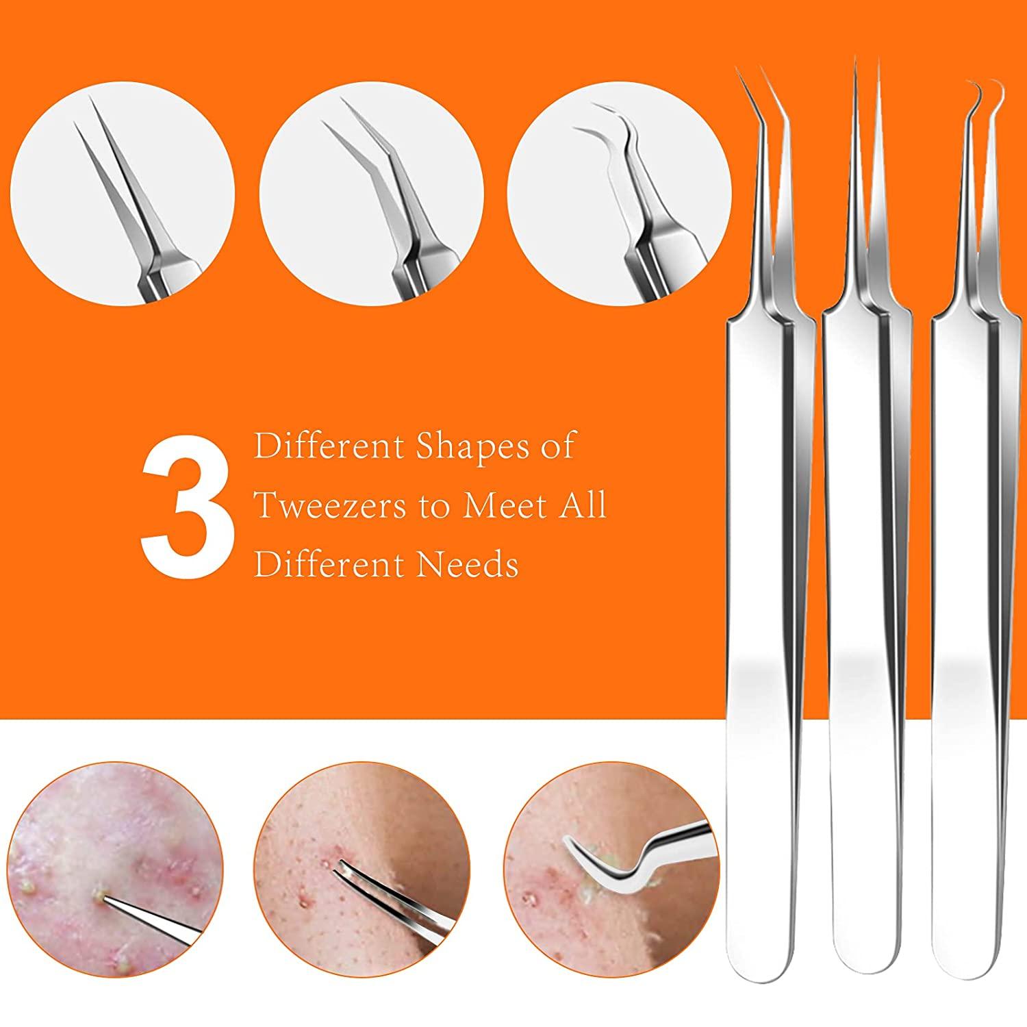 2022 15 PCS Blackhead Remover & Acne Extractor Tool Set - Stainless ...