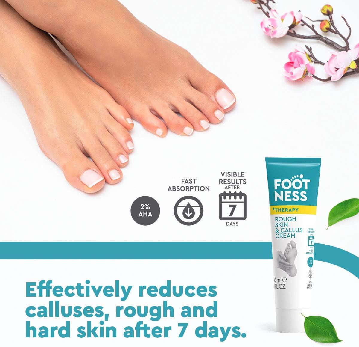 FOOTNESS Callus Cream with 2% Salicylic Acid - Smooth & Soften Rough ...