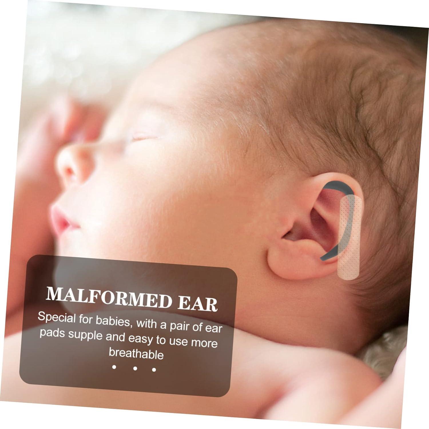 6 Pairs Auricle Corrector Tools - Protruding Ear Corrector with Silica ...