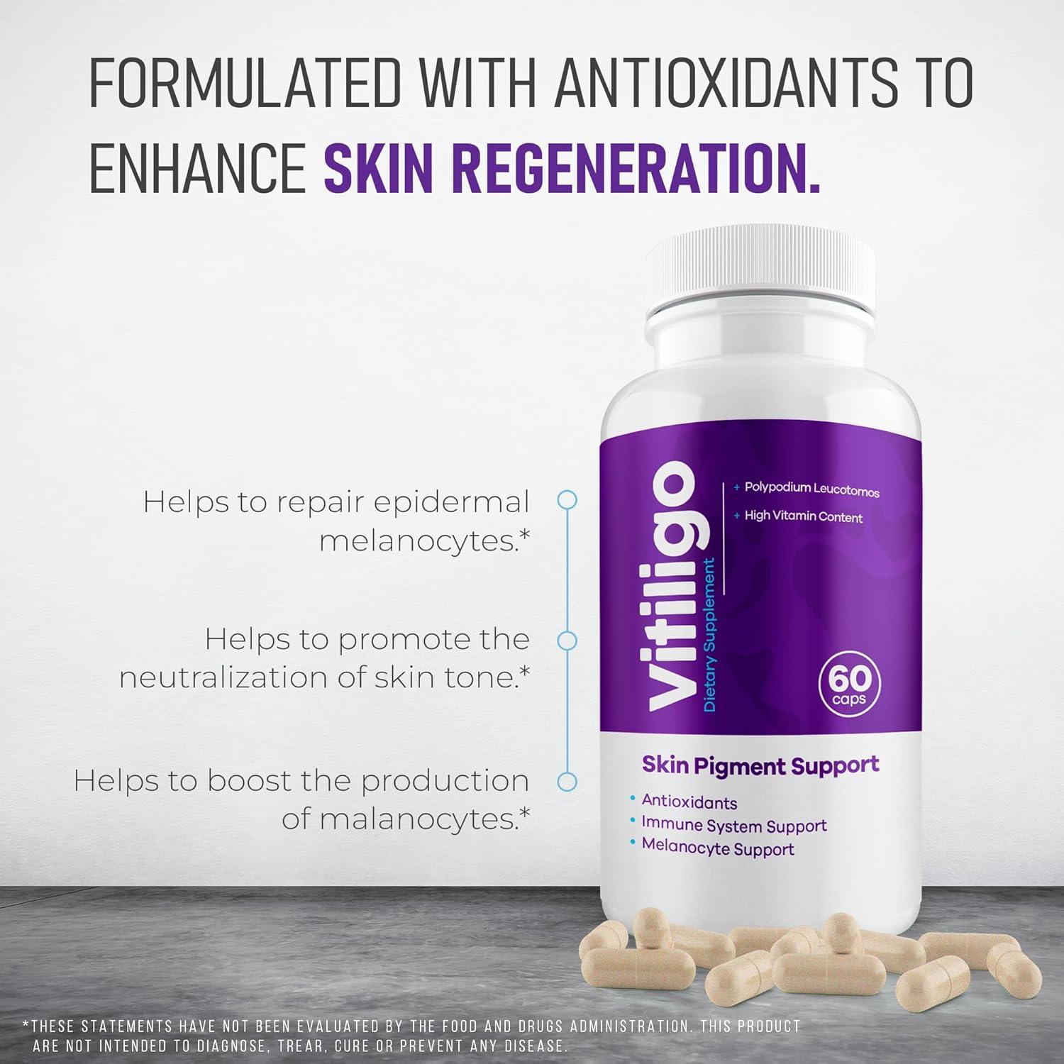 AURA VITAMINS Vitiligo Supplement for White Spots on Skin Improve Skin ...