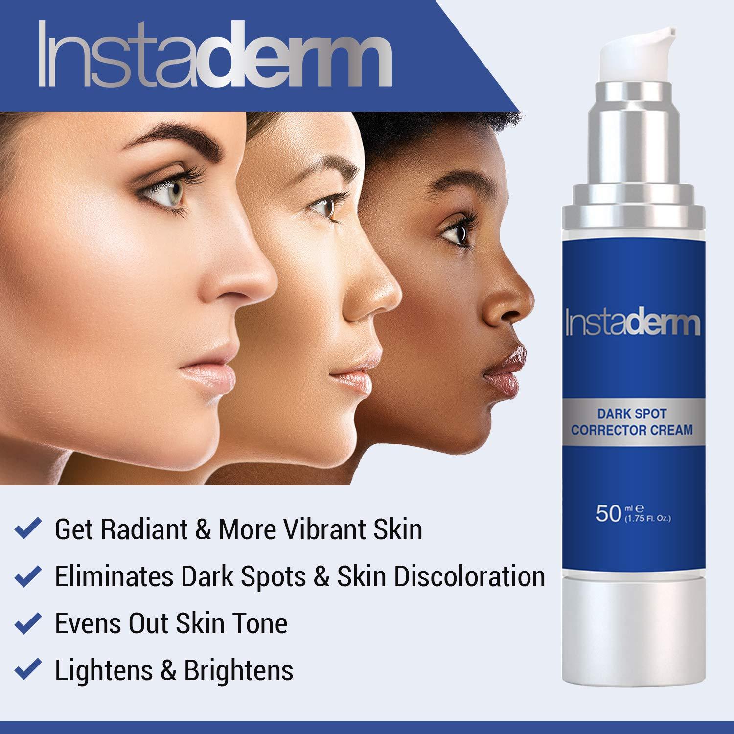 Dark Spot Corrector Cream | Fade Sun Spots, Acne Scars & Age Spots ...