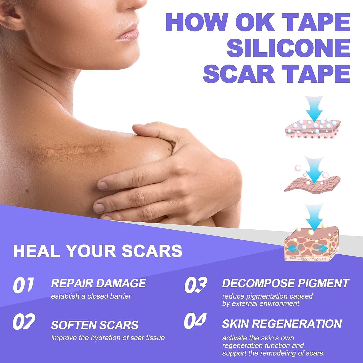 OK TAPE Silicone Scar Tape Roll - Professional Scar Removal Sheets for ...