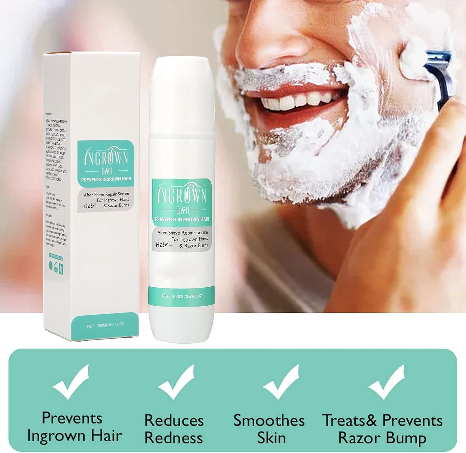 Razor Bumps Solution: 100ml Roll-on After Shave Repair Serum for Men ...