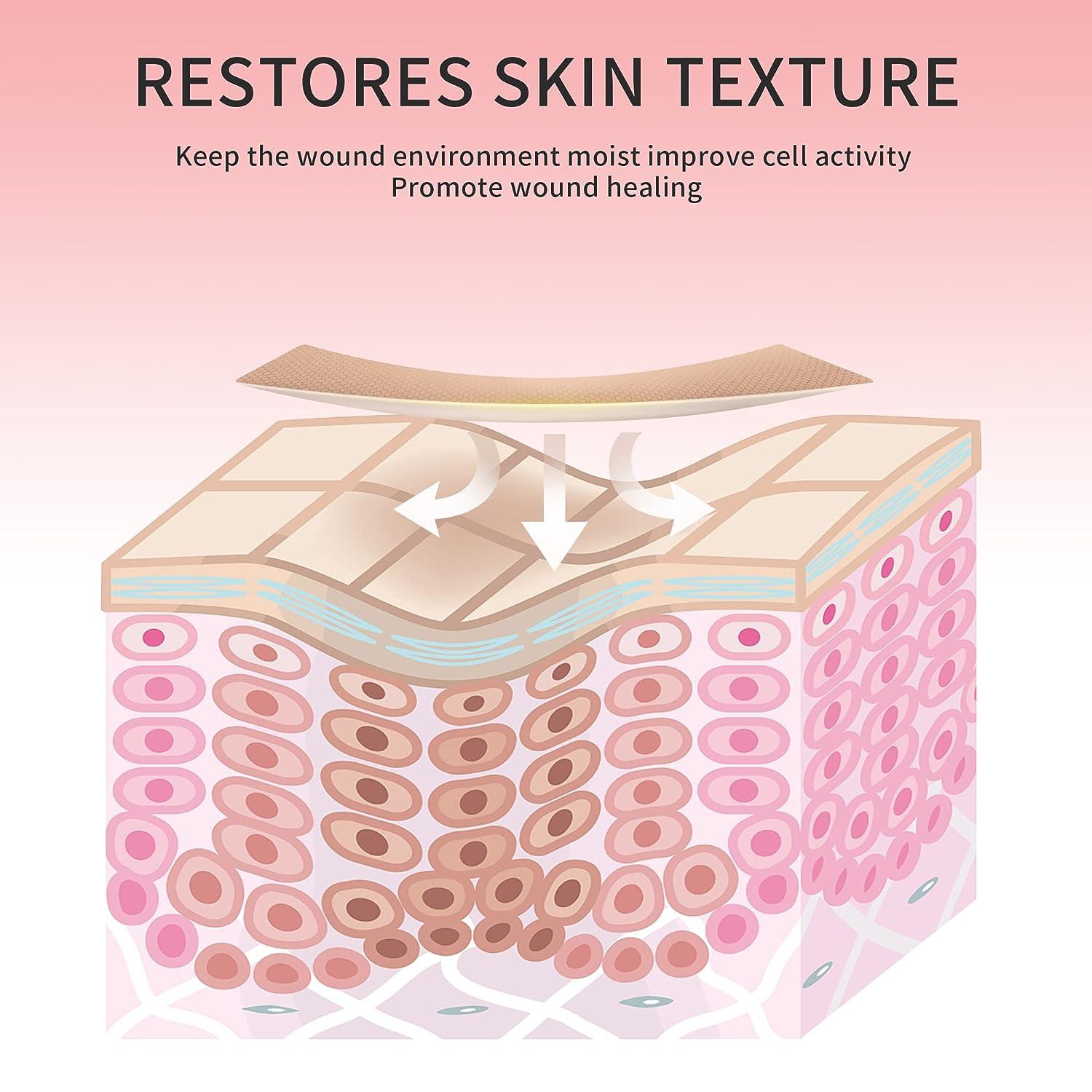 Sanfe Elephant Silicone Scar Sheets Roll - Professional Reusable Scar ...