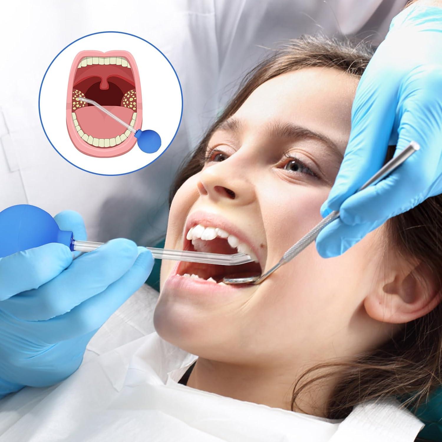 Premium Tonsil Stone Remover Tool Set | Cupping Glass & Tooth Mirror ...