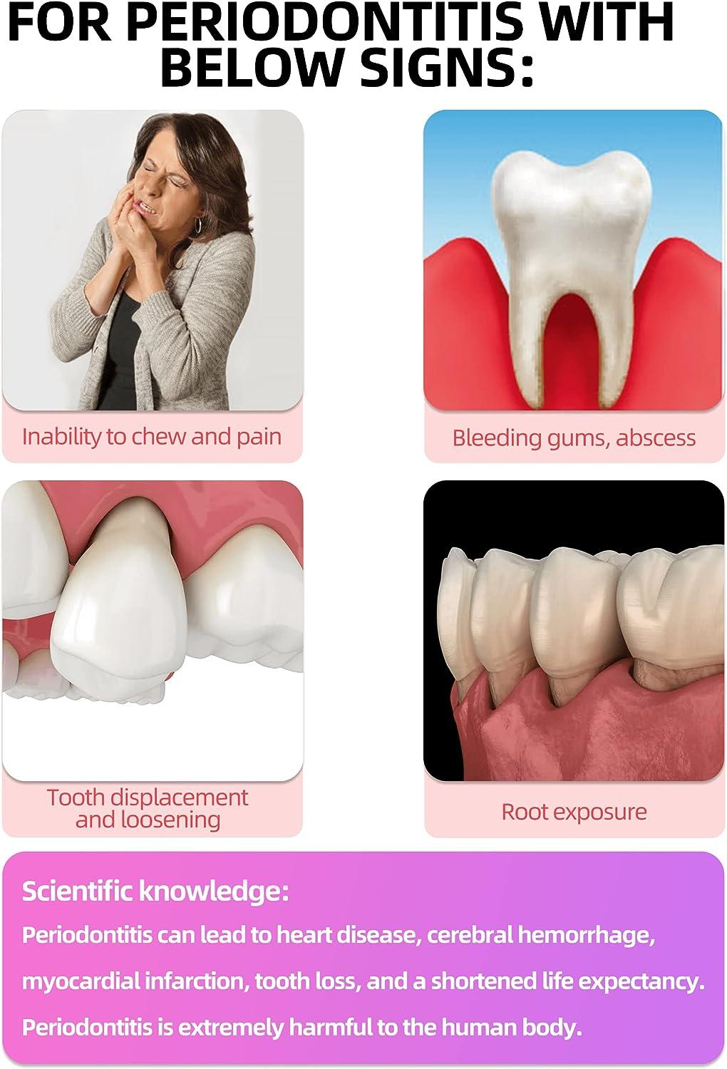 Dr. Glow Periodontal Disease Treatment Toothpaste for Bleeding Gums ...
