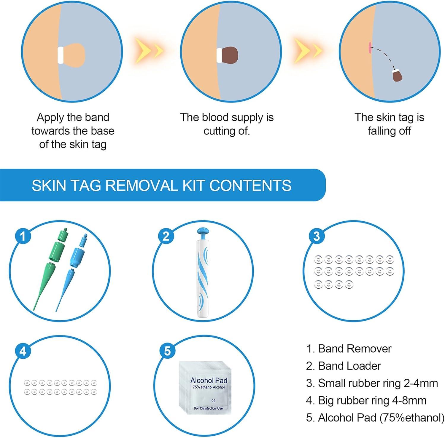 Skin Tag Remover Skin Tag Removal Kit Tools with 40 Micro and Regular ...