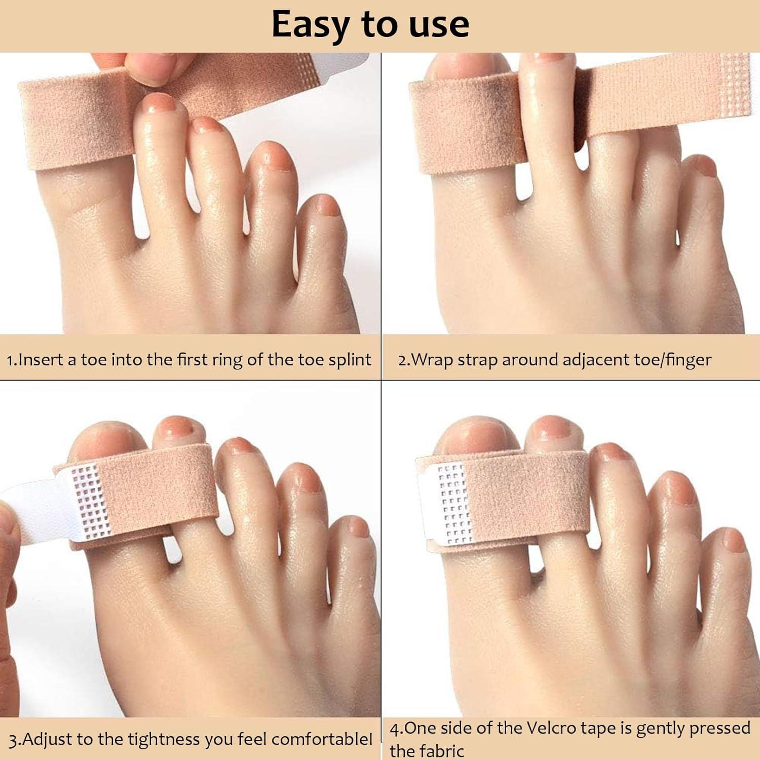 6Pcs Toe Straightener Splints & Cushioned Bandages - Correct Hammer ...