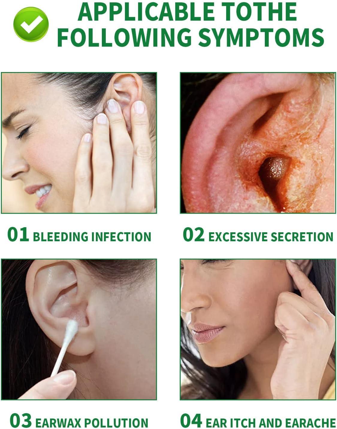 Birdfly Organic Ear Oil - Natural Ear Drops for Infestation Prevention ...