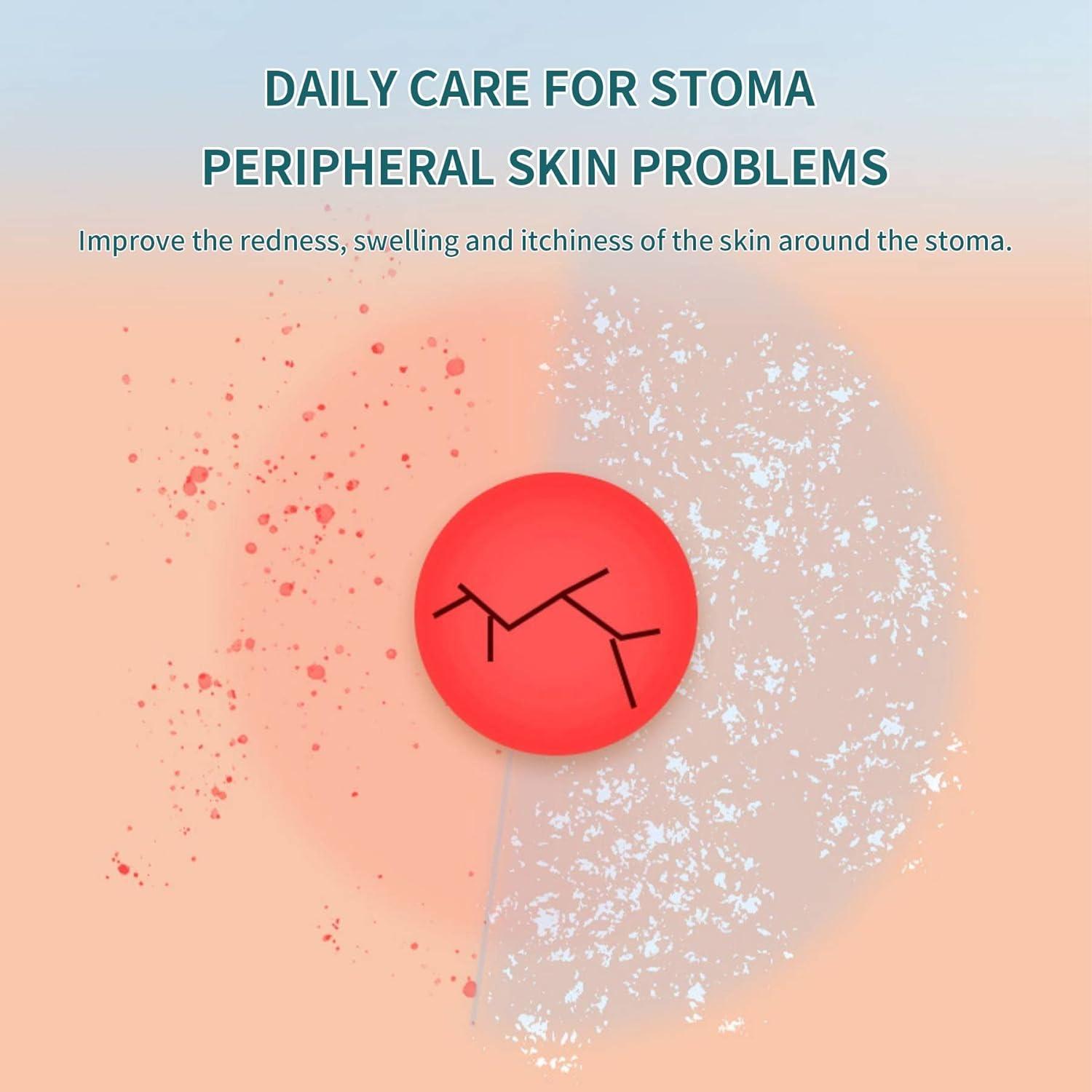 Stoma Powder - Skin Barrier Protection Ostomy Supplies | 1 oz (2 ...