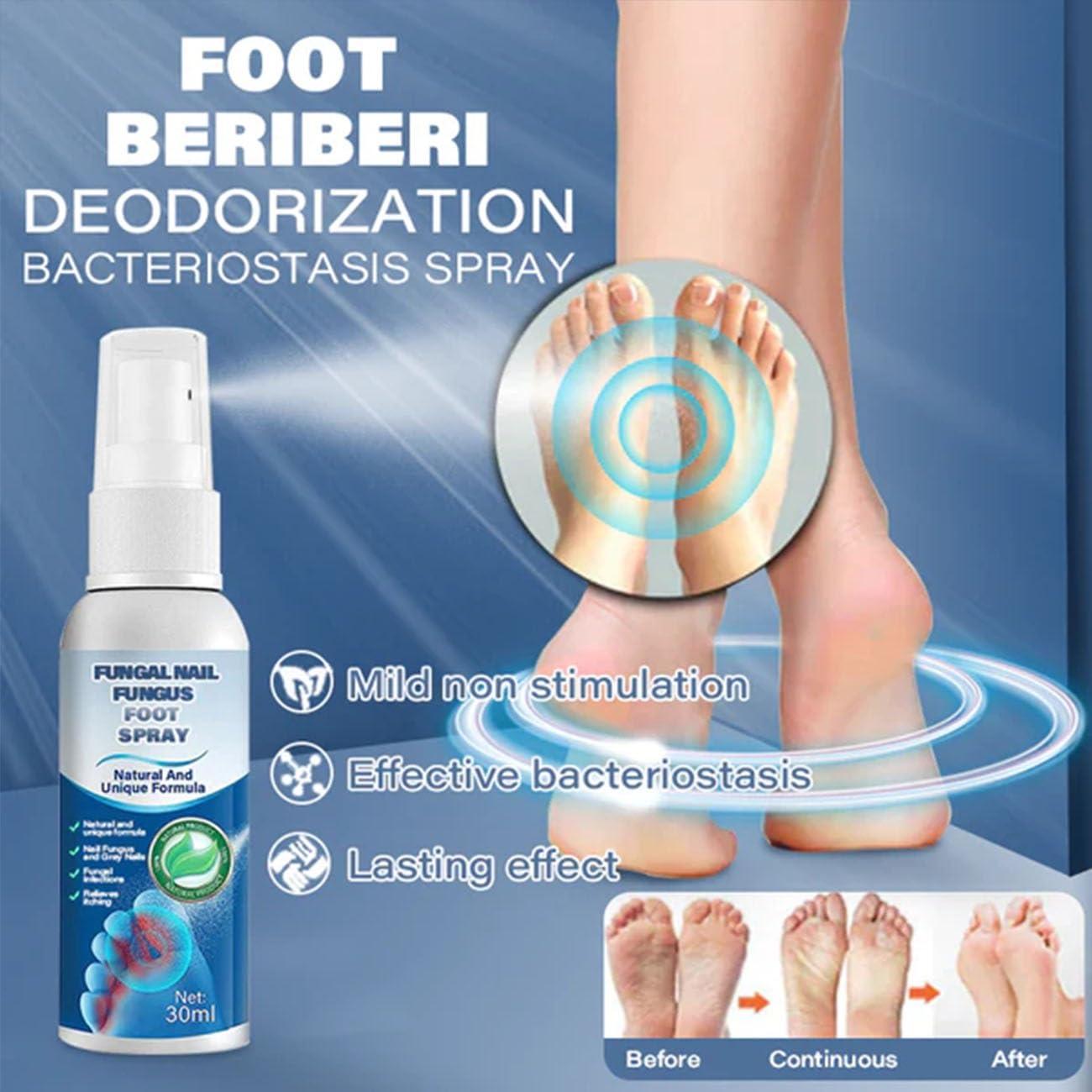 Medical Grade Athlete's Foot & Nail Treatment Spray - Easy to Use 30ml ...
