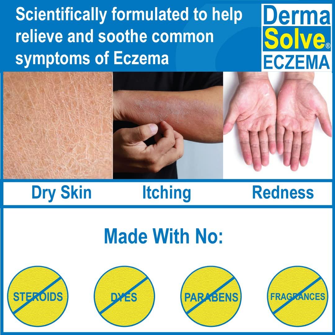 DermaSolve Eczema Relief Shampoo (2-Pack) for Scalp & Dandruff ...